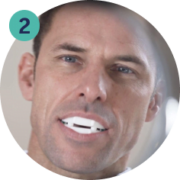 Snoreeze Oral Device | Snoring Oral Device